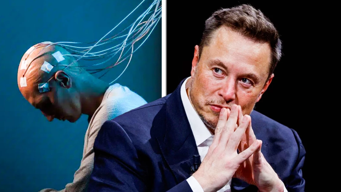 Elon Musk: Επιτυχής εμφύτευση του chip εγκεφάλου της Neuralink σε ...